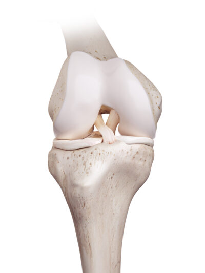 Treatment Options for Cranial Cruciate Ligament Rupture in Dogs ...